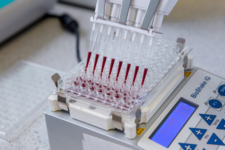 Platelet Aggregation Services | Whole Blood | Platelet Services