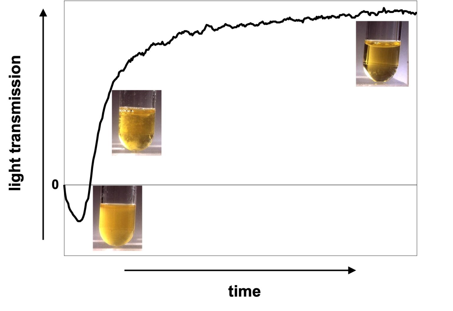 Platelet Aggregation Test | Light Transmission Aggregometry (LTA)